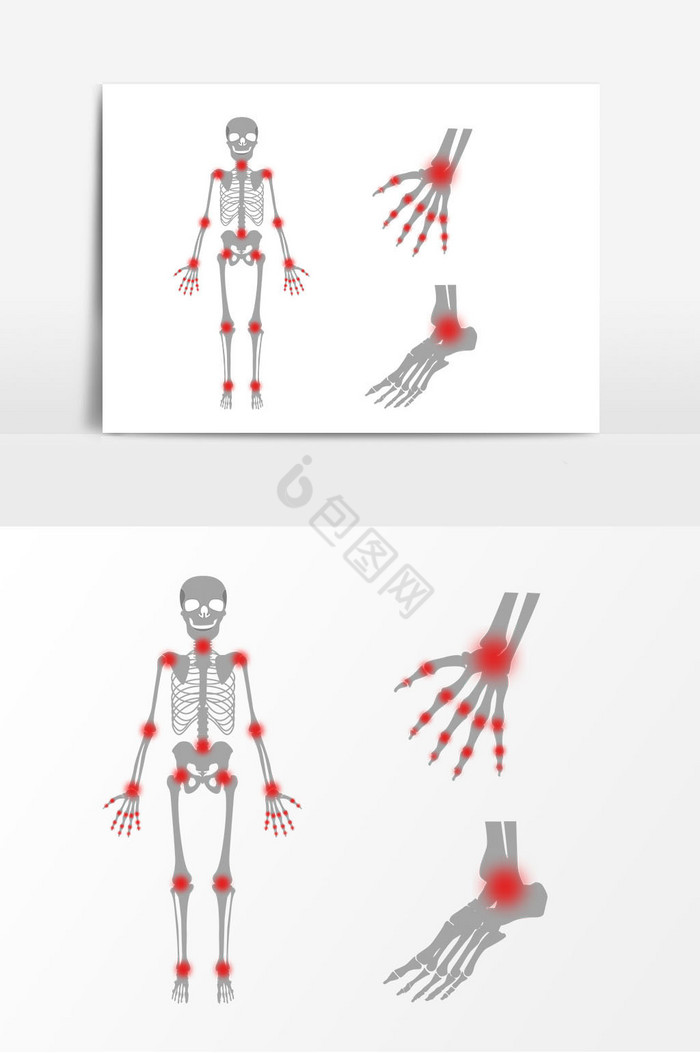 人体关节结构图图片-人体关节结构图素材免费下载-包图网