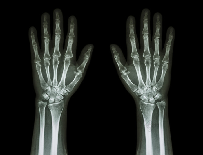 射线手前视图正常人的手图片-包图网企业站